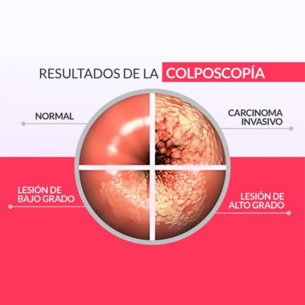 Ginecología - Centro Médico Callao
